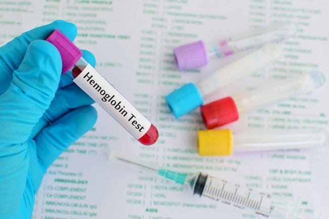 Kadar Hb Normal Ibu Hamil dan Cara Menjaganya - Alodokter